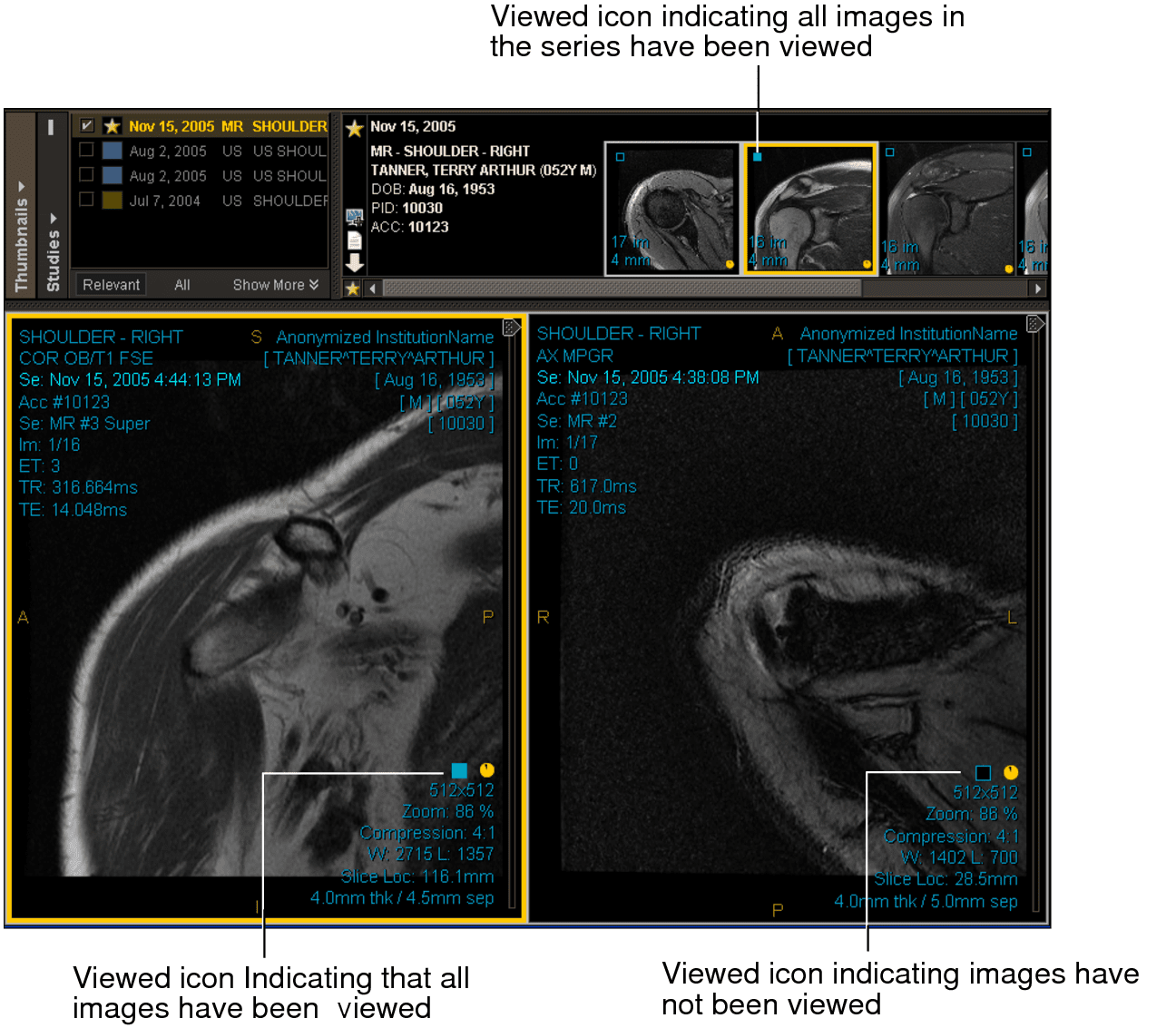 IntelePACS Reviews 2025: Pricing, Features & More