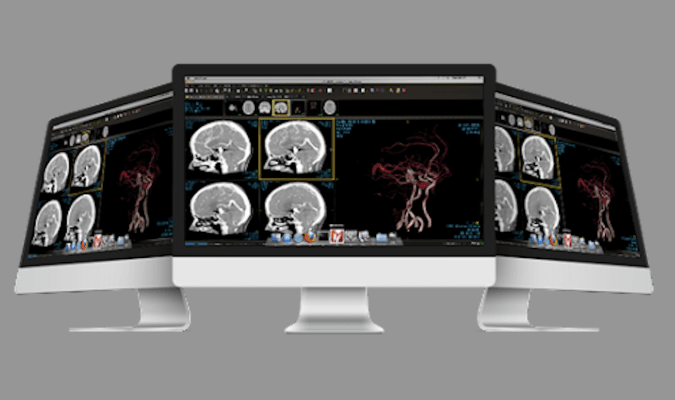 IntelePACS Reviews 2025: Pricing, Features & More