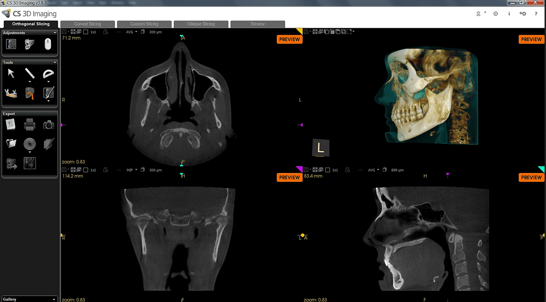 Carestream Dental Reviews 2025: Pricing, Features & More