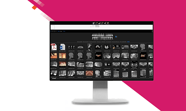 Carestream Dental Reviews 2025: Pricing, Features & More