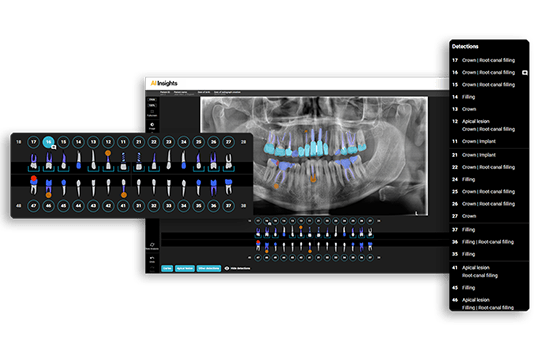Carestream Dental Reviews 2025: Pricing, Features & More