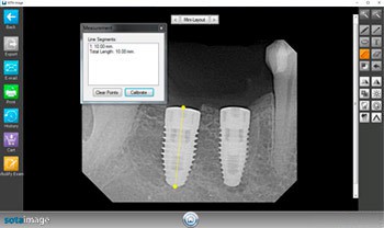SOTA Imaging Reviews 2025: Pricing, Features & More