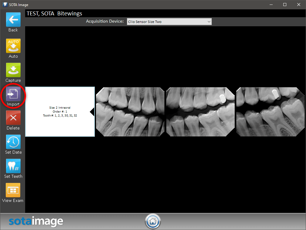 SOTA Imaging Reviews 2025: Pricing, Features & More