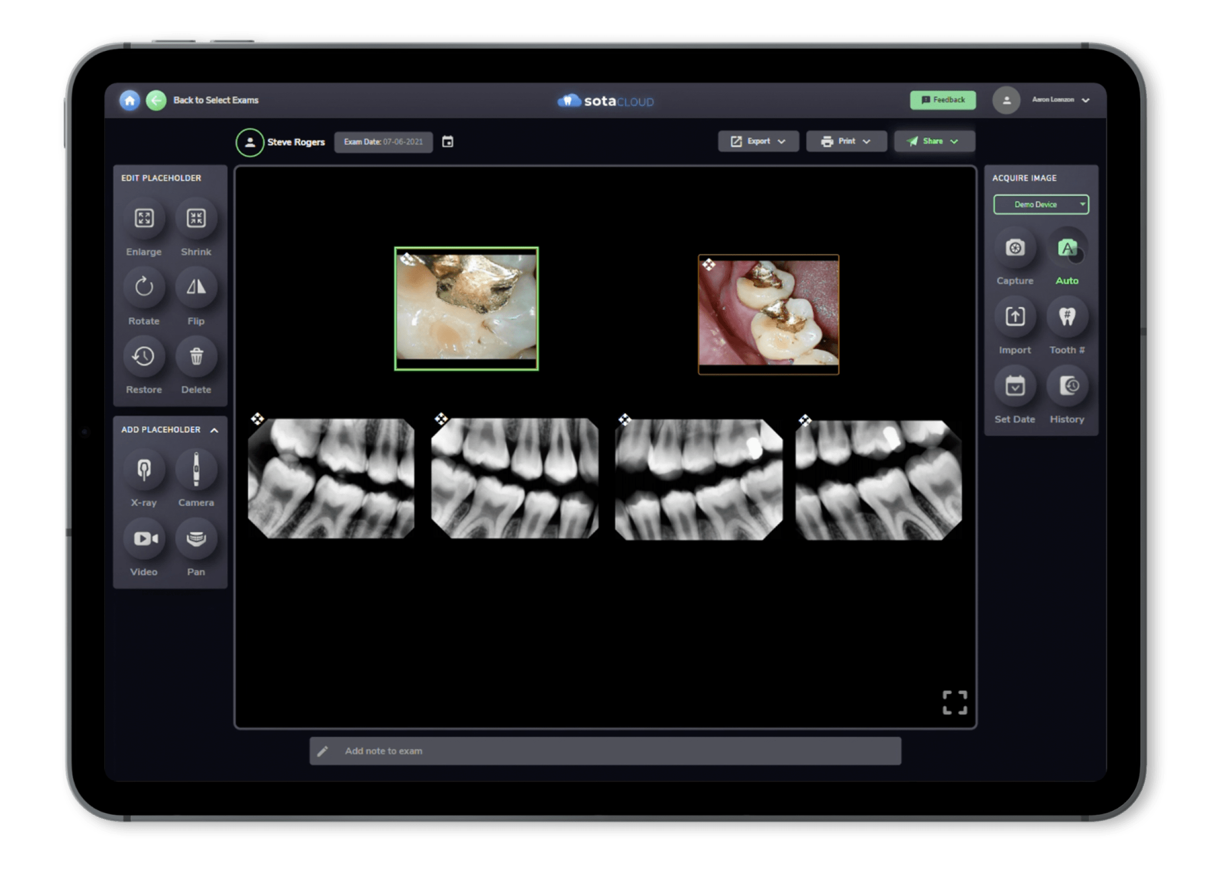 SOTA Imaging Reviews 2025: Pricing, Features & More