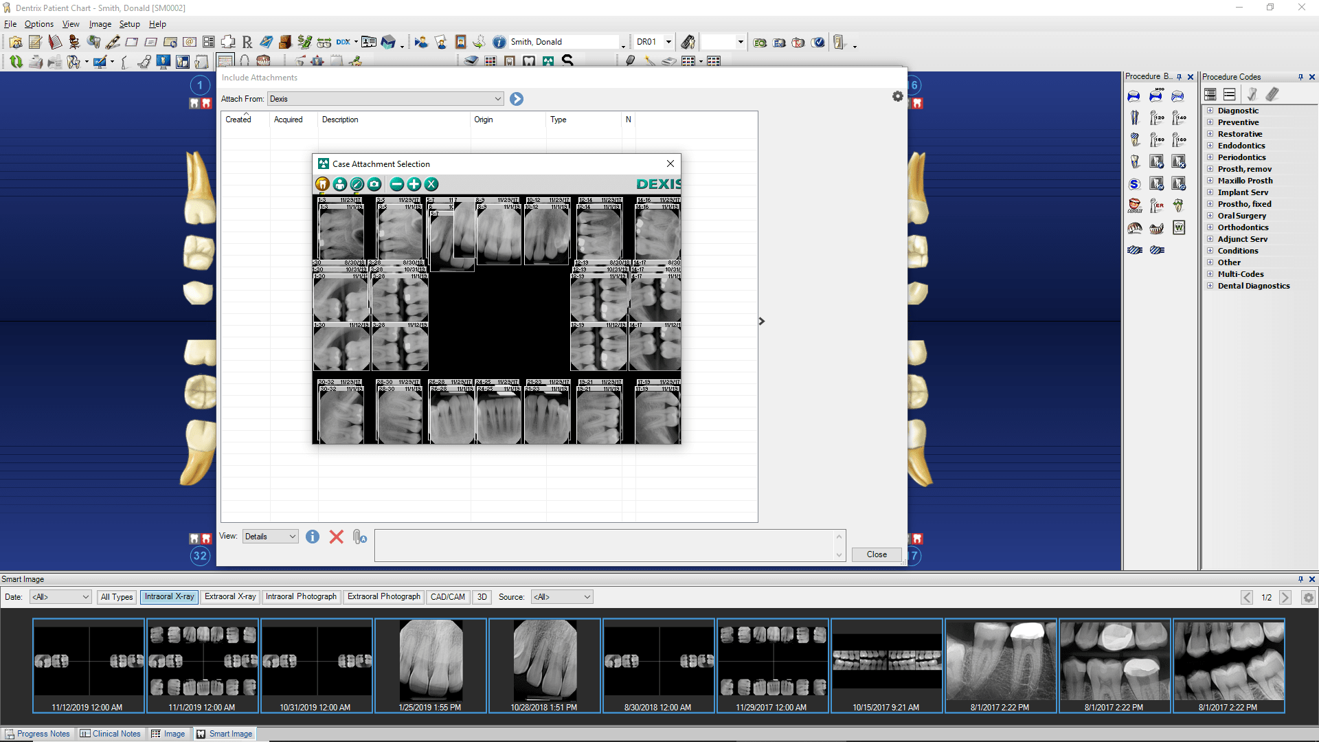 Dexis Reviews 2025: Pricing, Features & More